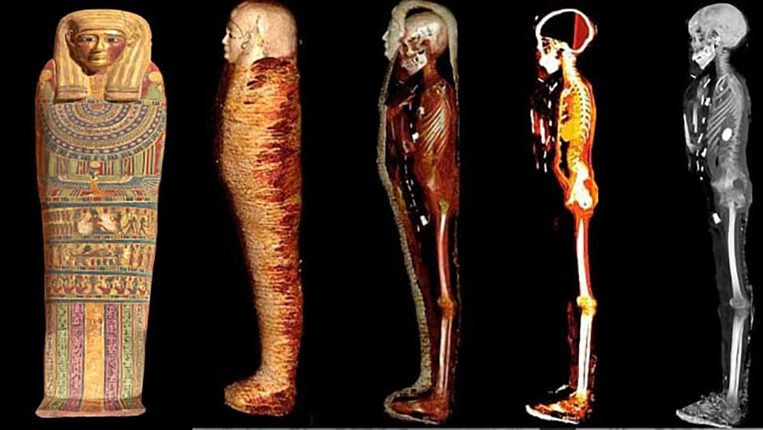 Realizan tomografía a momia de 12 mil años y encuentran ¡oro! - Zócalo